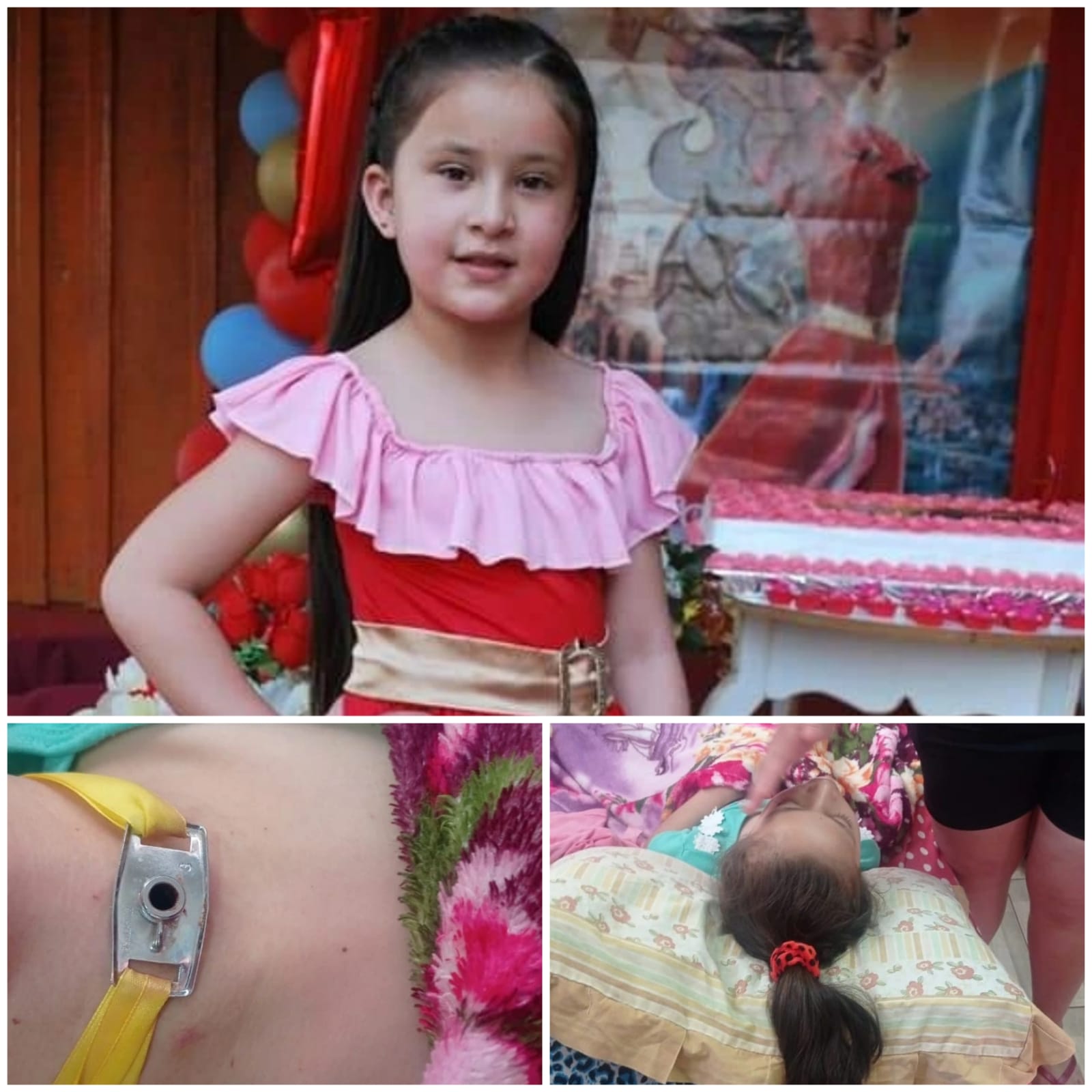 Niña de 8 años necesita 32.000 reales para realizarse cirugía ...